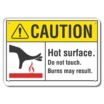 Hot Surface Signs - Grainger Industrial Supply